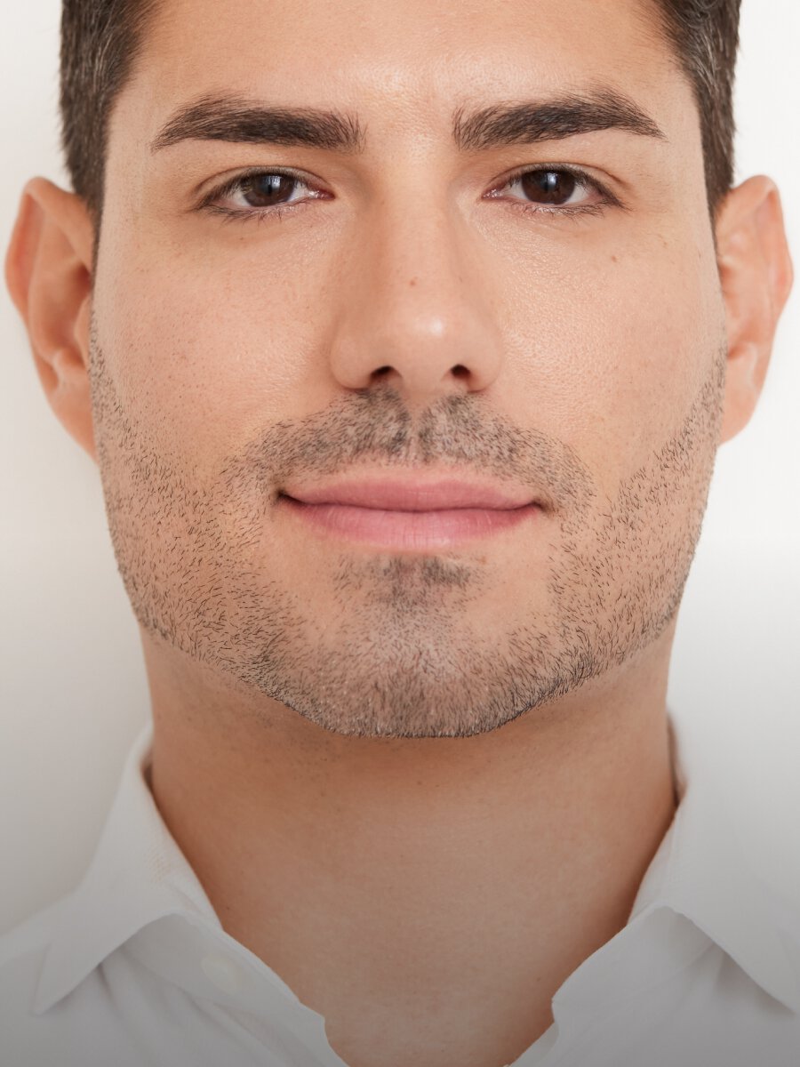 Facial Plastic Surgery Beverly Hills | Harris Facial Plastic Surgery